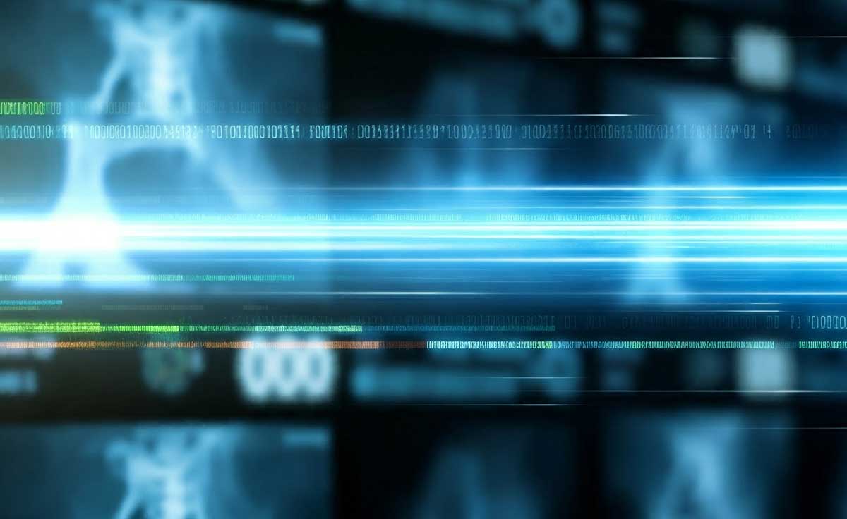 About DICOM Transfer Syntaxes - AdvaPACS